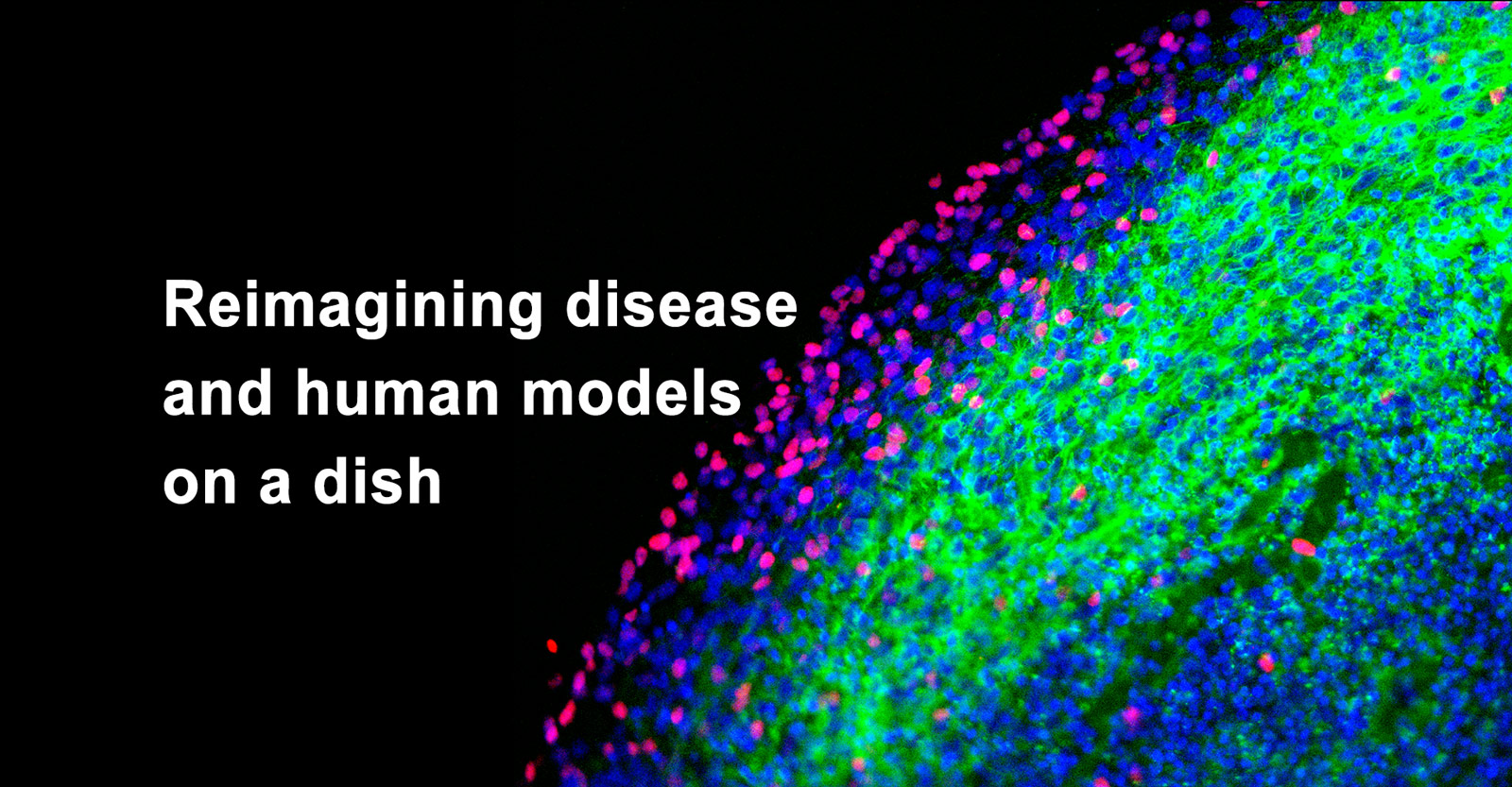 Reimagining disease and human models on a dish | ACROBiosystems