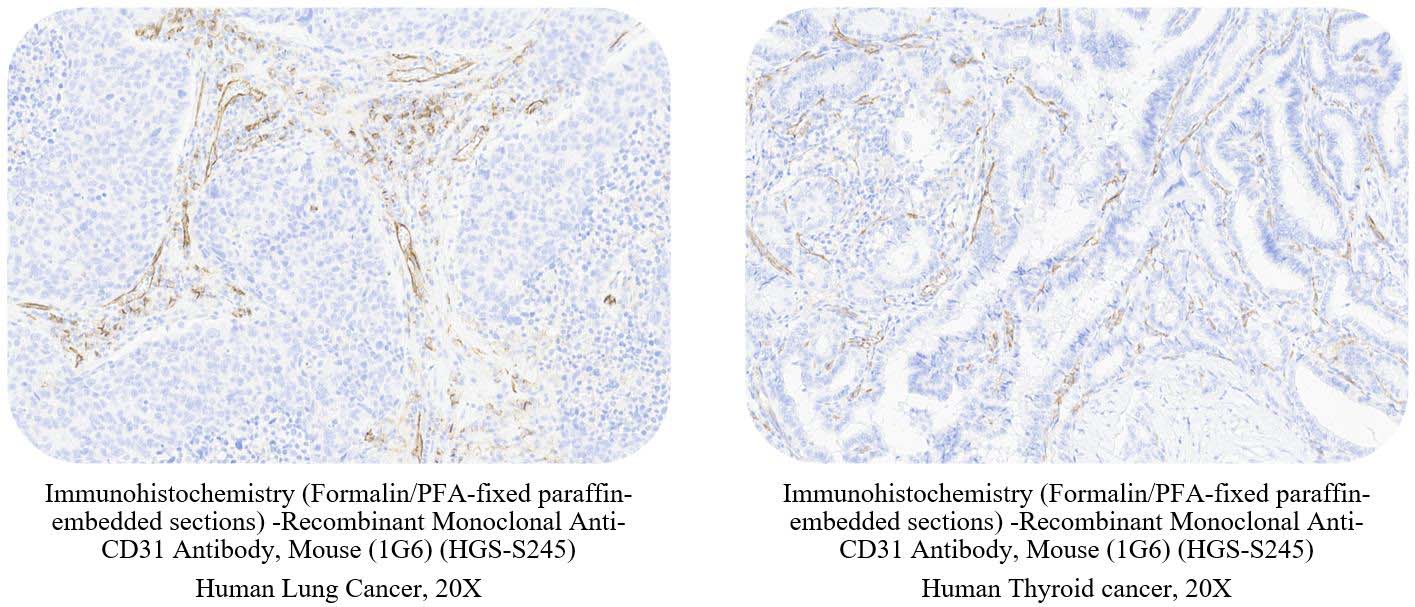 Recombinant Monoclonal Anti-CD31 Antibody, Mouse (1G6) | ACROBiosystems