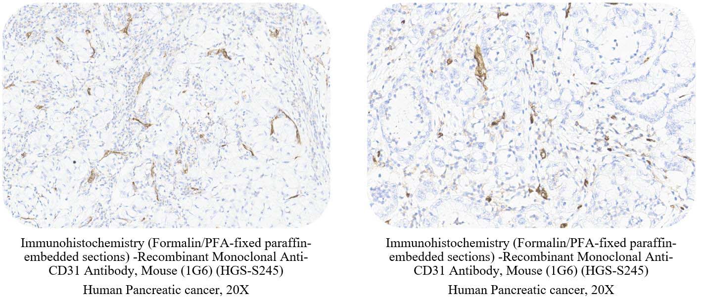 Recombinant Monoclonal Anti-CD31 Antibody, Mouse (1G6) | ACROBiosystems