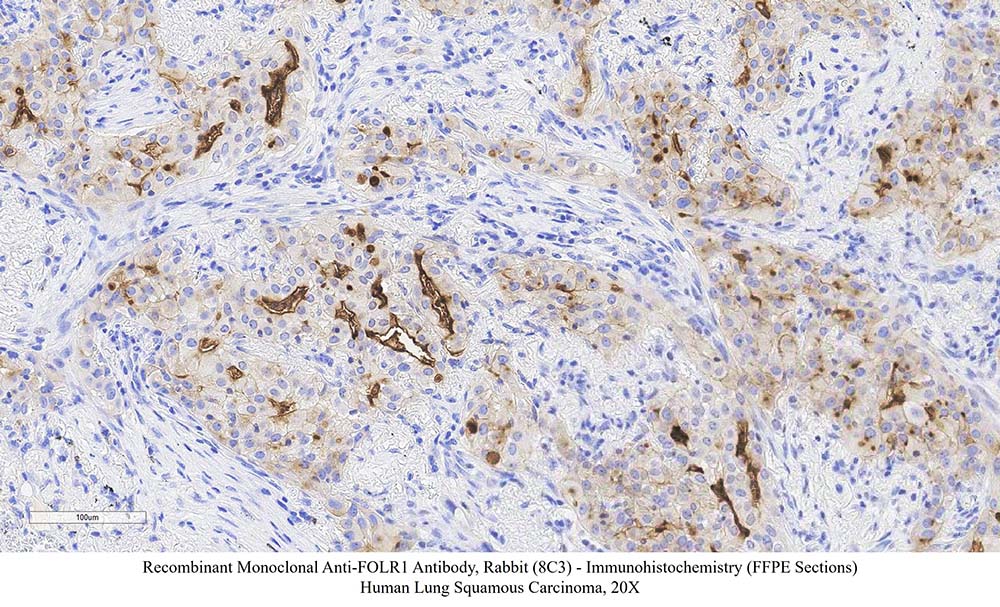 Recombinant Monoclonal Anti-FOLR1 Antibody, Rabbit (8C3) | ACROBiosystems