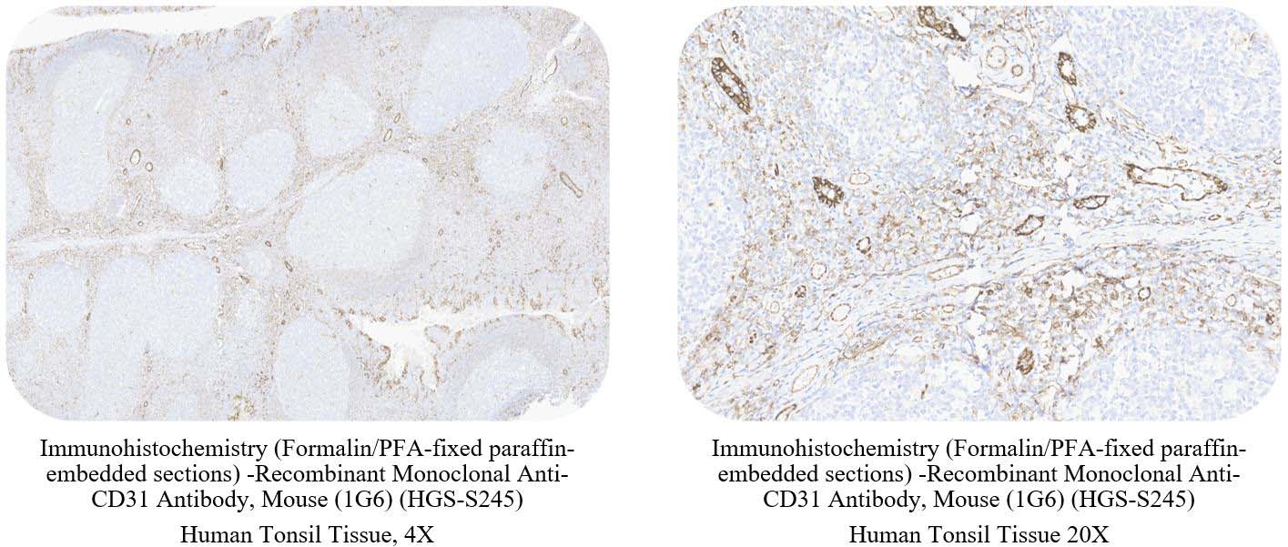 Recombinant Monoclonal Anti-CD31 Antibody, Mouse (1G6) | ACROBiosystems