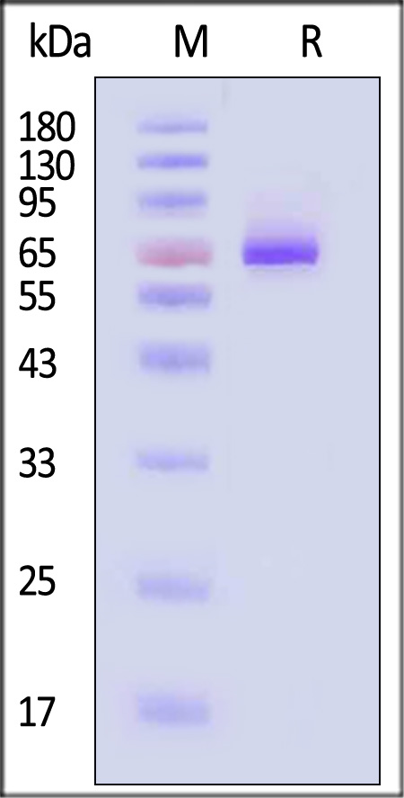 Human ALPL Protein, His Tag (active enzyme, MALS verified) | ACROBiosystems