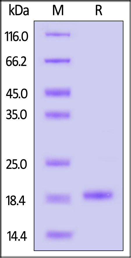 Human Alpha-Synuclein (A53T) Protein, His Tag (MALS verified ...