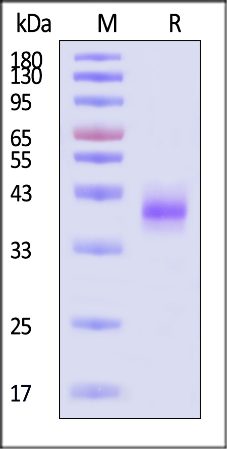 Enterokinase (MALS verified) | ACROBiosystems