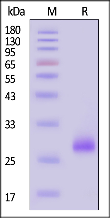 Human IFN-omega Protein, His Tag (BLI & MALS verified) | ACROBiosystems