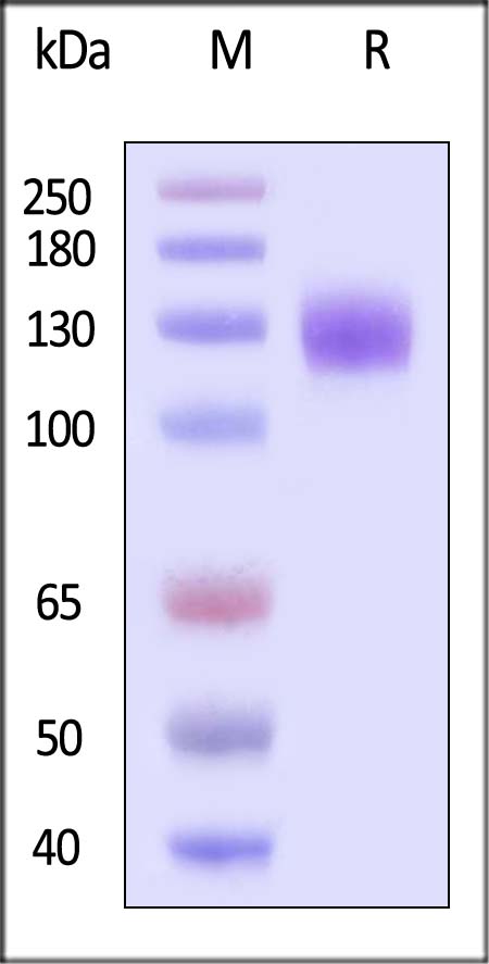 Cynomolgus IL-31 RA Protein, Fc Tag | ACROBiosystems