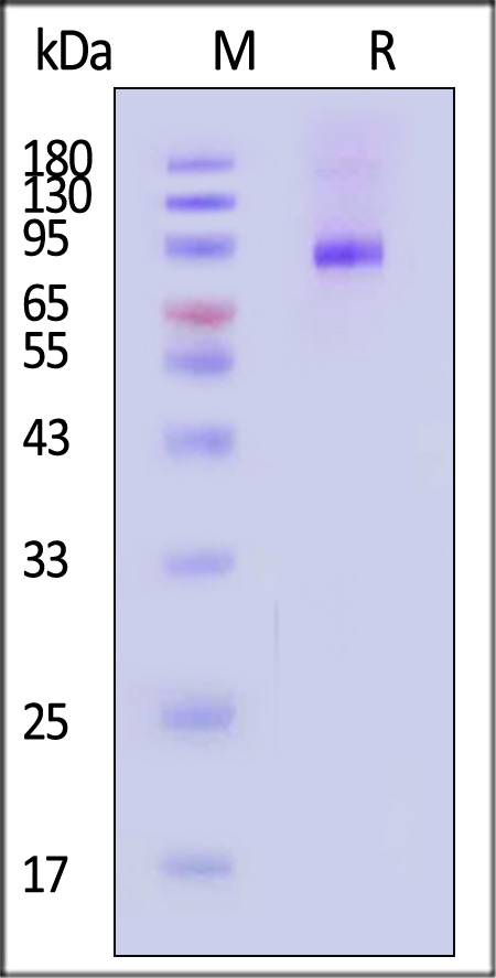 Biotinylated Human IL-12 R beta 2 Protein, His,Avitag™ (MALS verified ...