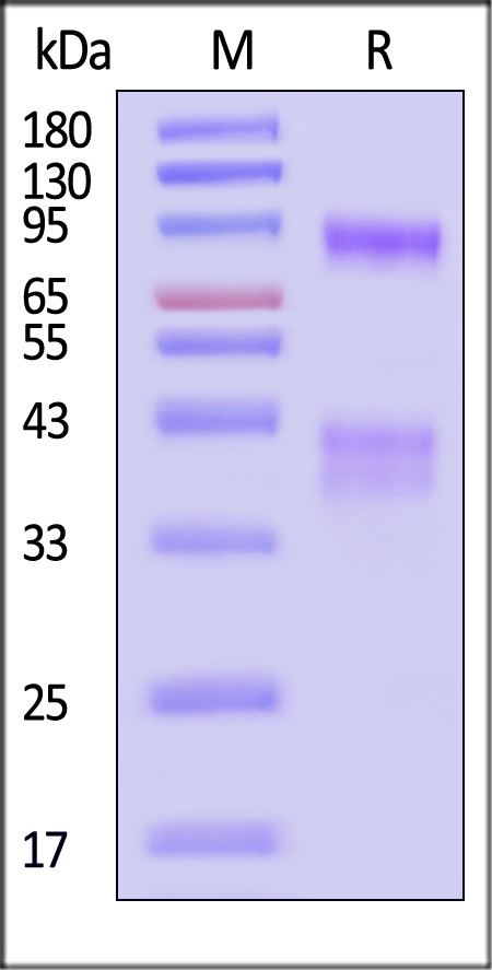 Cynomolgus IL-2 R beta&IL-2 R alpha&IL-2 R gamma (27-240, 22-213, 23 ...
