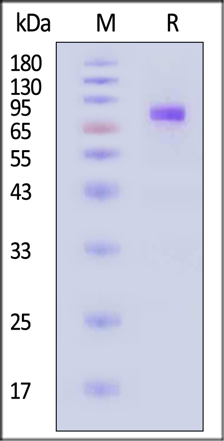Human IL-1 RI Protein, Fc Tag (MALS verified) | ACROBiosystems