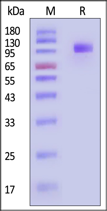 Human IL-35 R / gp130 & IL12Rb2 Protein, His Tag (MALS verified ...