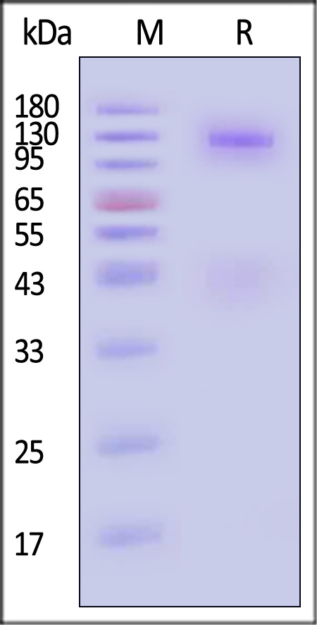 Biotinylated Human Insulin R / CD220 (28-944) Protein, His,Avitag ...