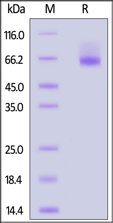Human Nogo Receptor / NgR Protein, His Tag (SPR verified) | ACROBiosystems