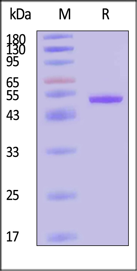 Rabies virus (strain ERA) Nucleoprotein, His Tag | ACROBiosystems
