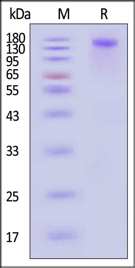Human SEZ6 Protein, His Tag (MALS verified) | ACROBiosystems