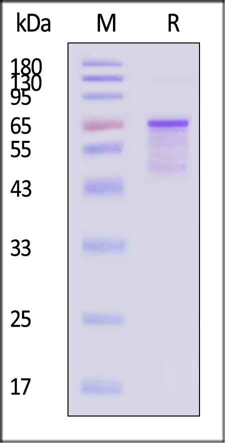 Human Tau-441 GSK-3beta-phosphorylated protein, His Tag | ACROBiosystems