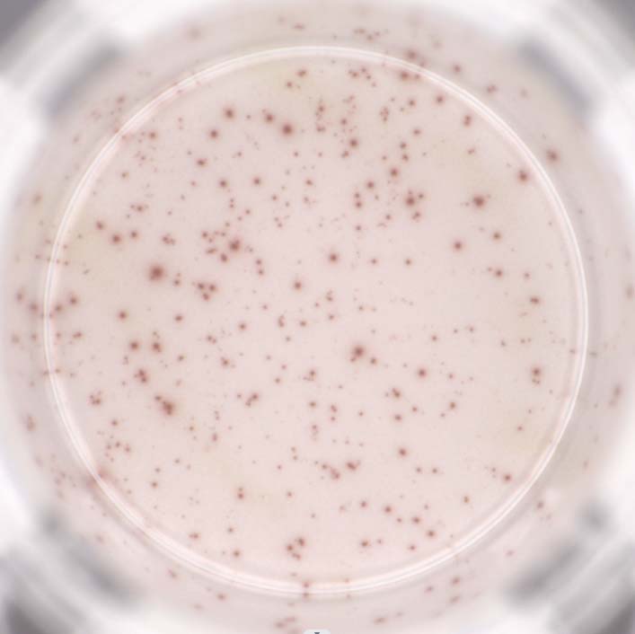 Mouse TNF-alpha ELISPOT Kit | ACROBiosystems