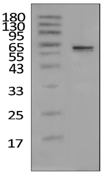 Human Tau-441 GSK-3beta-phosphorylated protein, His Tag | ACROBiosystems